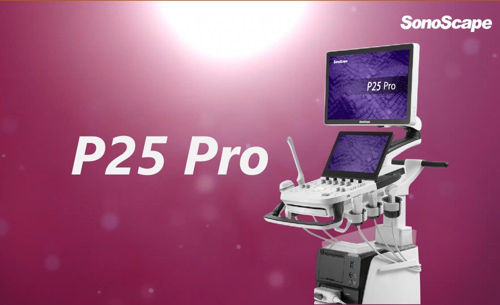 Máy siêu âm màu 5D Sonoscape P25 Pro – Phú Việt Medical là nhà phân phối chính hãng dòng SonoScape